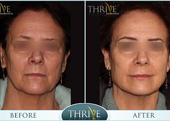 3 Best Med Spa in Portland, OR - Expert Recommendations